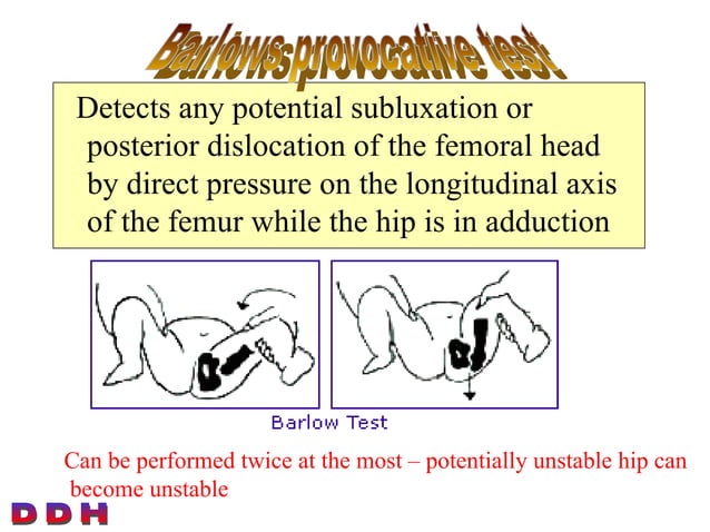 DDH Developmental Dysplasia of the Hip.ppt