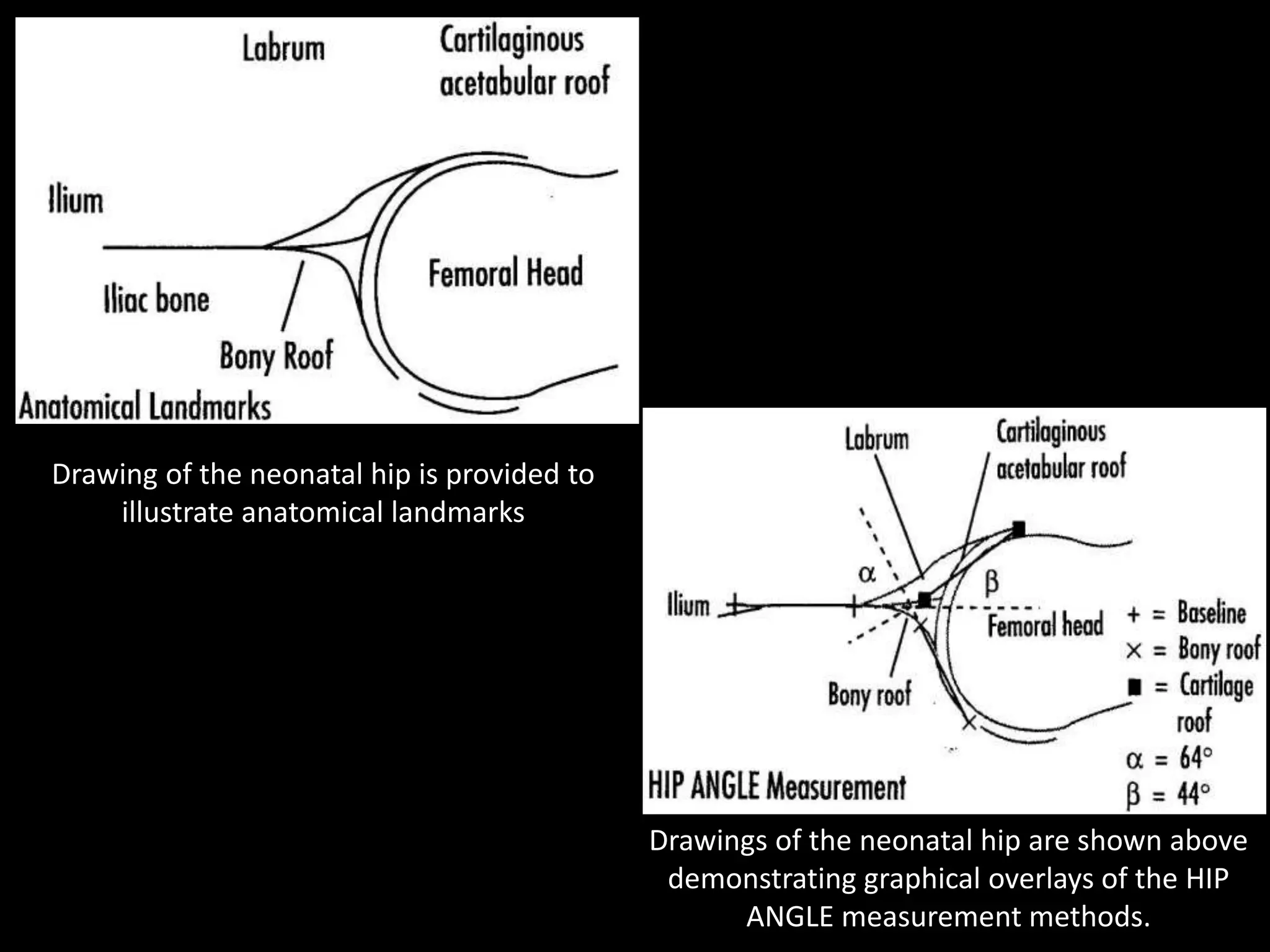 Ddh final dt2 | PPTX
