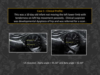 Ddh final dt2 | PPTX