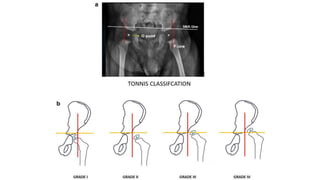 DDH introduction and algorithm.pptx