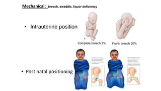 DDH introduction and algorithm.pptx