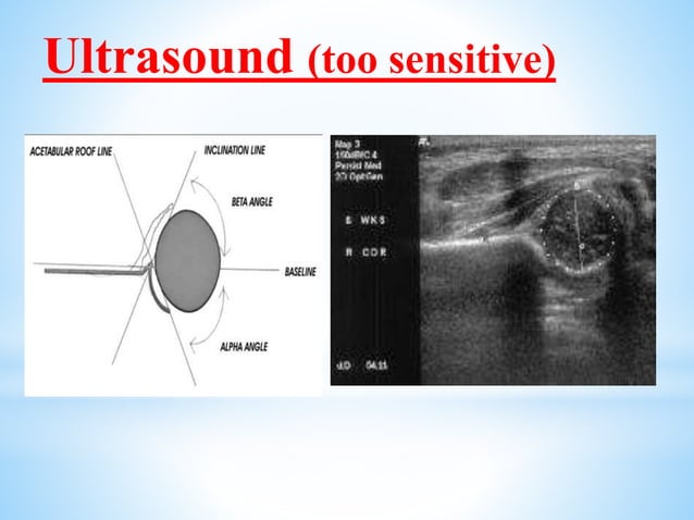 Ddh mostafa raslan | PPT