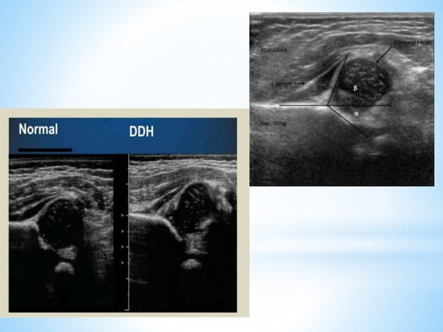 Ddh mostafa raslan | PPT