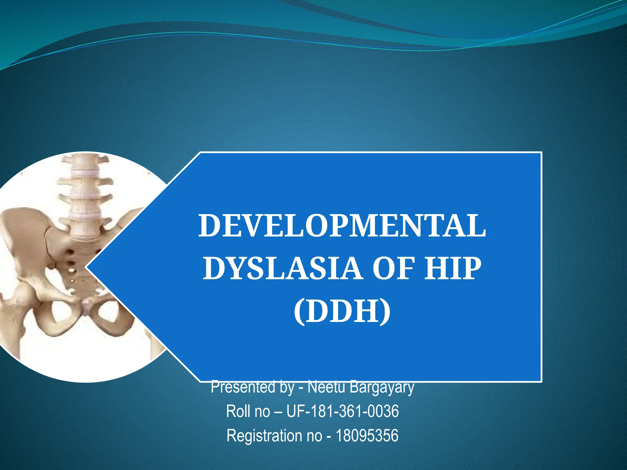Developmental Dysplasia of Hip (DDH) or Congenital Dislocation of Hip (CDH) | PPTX | Pregnancy ...