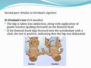 Developmental Dysplasia of Hip (DDH) or Congenital Dislocation of Hip ...