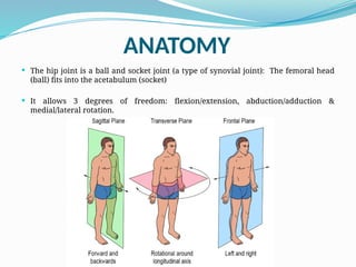 Developmental Dysplasia of Hip (DDH) or Congenital Dislocation of Hip ...