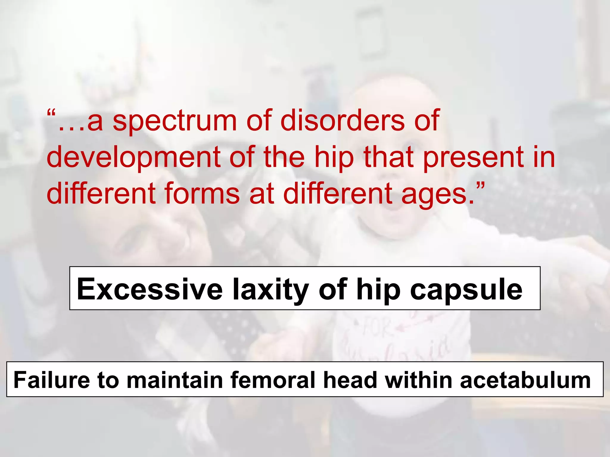 Jose Austine- Evaluation of Developmental Dysplasia of Hip | PPTX