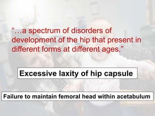 Jose Austine- Evaluation of Developmental Dysplasia of Hip | PPTX