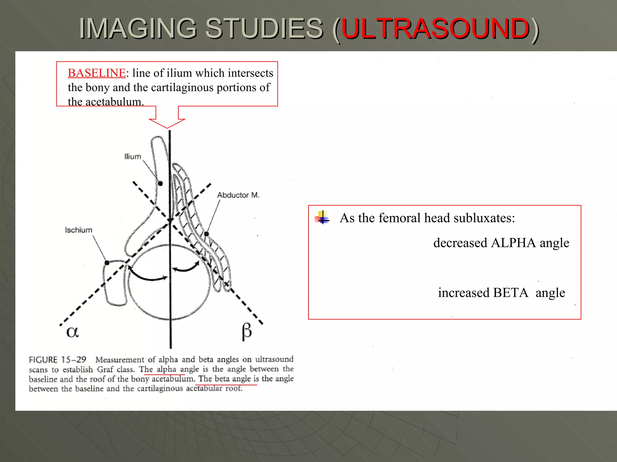 Developmental Dysplasia of the Hip and Ultrasound | PPT
