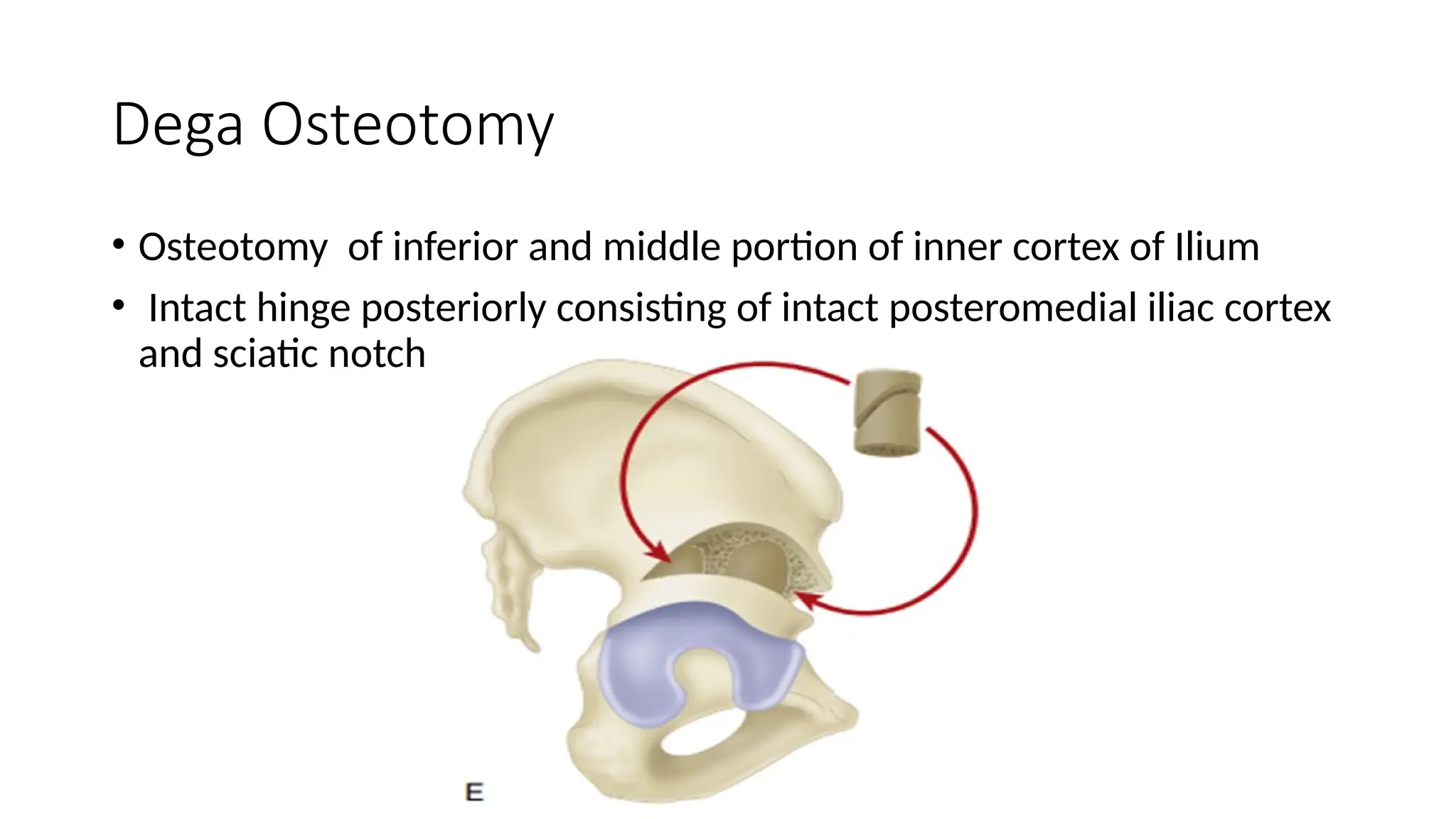 DDH Treatment Overview Paediatrics .pptx