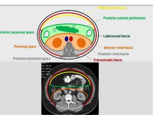 Peritoneum , Intraperitoneal Spaces