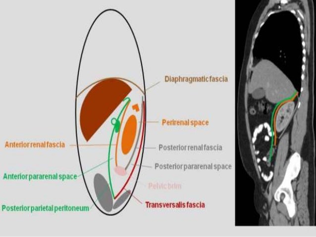 Peritoneum , Intraperitoneal Spaces