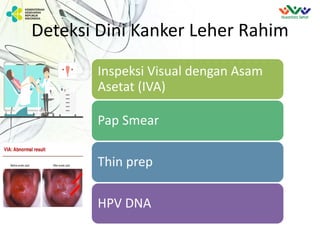 Dd kanker ns 2020 ok | PDF