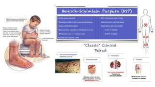Differential Diagnosis of Arthritis in Children | PPTX
