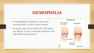 Differential Diagnosis of Arthritis in Children | PPTX
