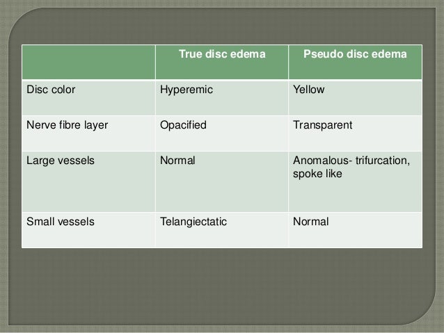Dd of disc edema