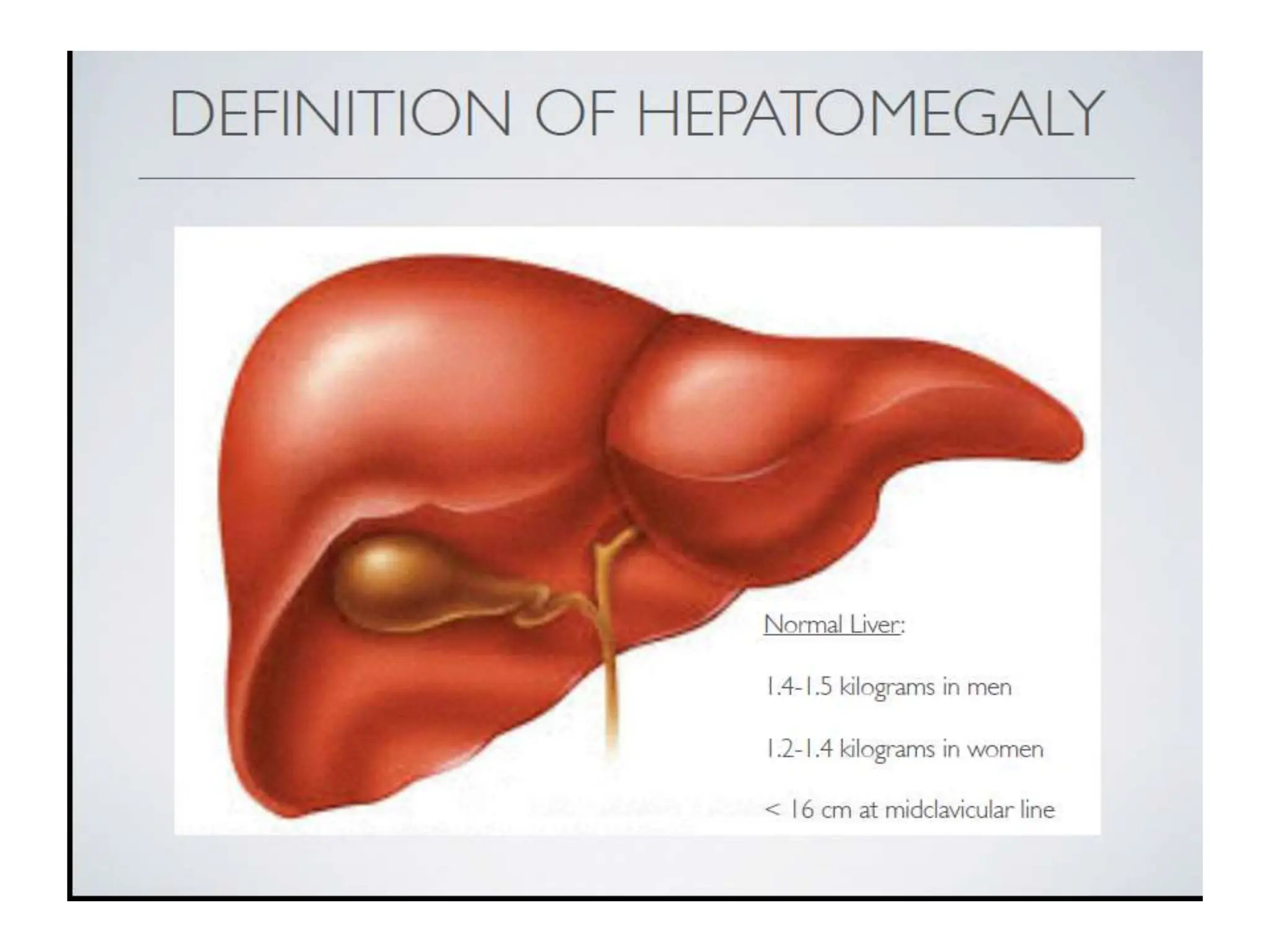 Differential Diagnosis of Hepatomegaly.pptx