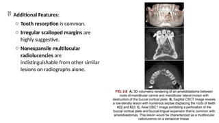 Differential Diagnosis OF PERIAPICAL LESION.pptx