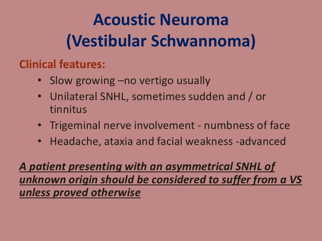 Peripheral vertigo - novanored
