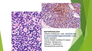 dd of round cell tumor histology -1.pptx
