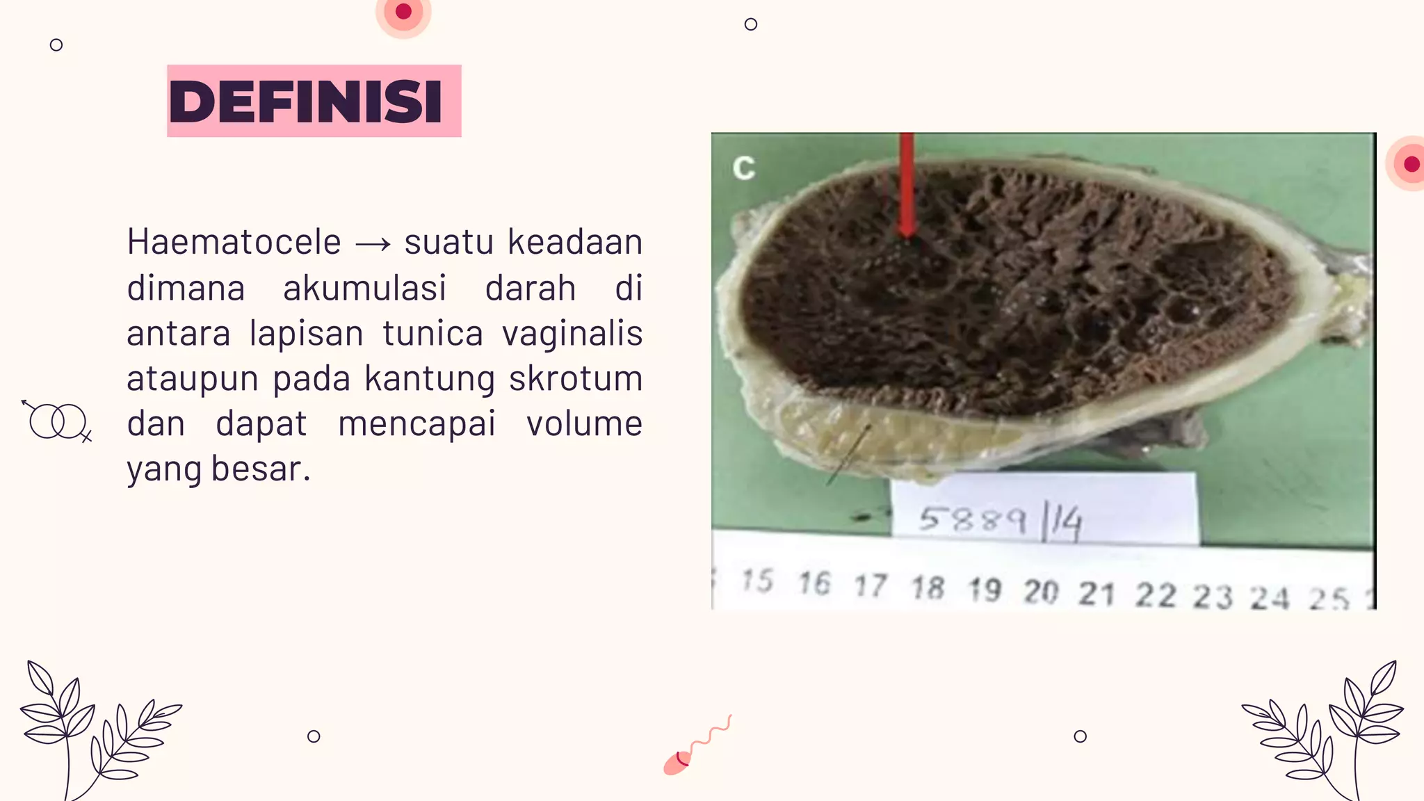 DD_PERBESARAN_SKROTUM.pptx