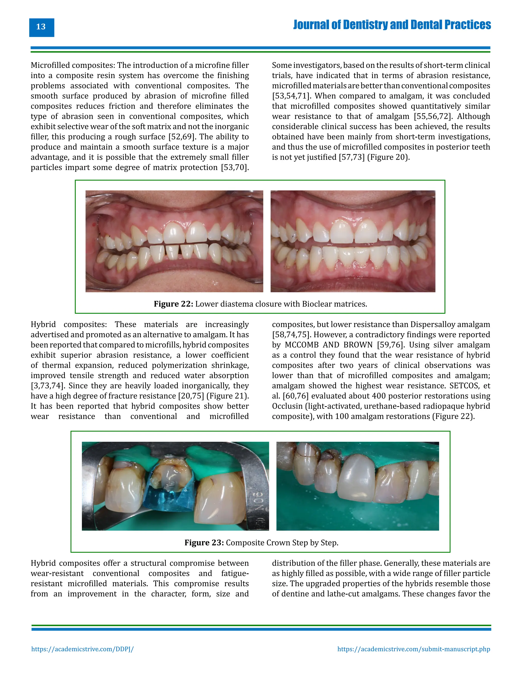 Recent Advances in Dental Composites: An Overview | PDF