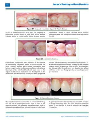 Recent Advances in Dental Composites: An Overview | PDF