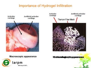 Drug delivery with Hydrogel | PPTX