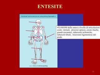 Dd spondiliti lombalgie | PPT