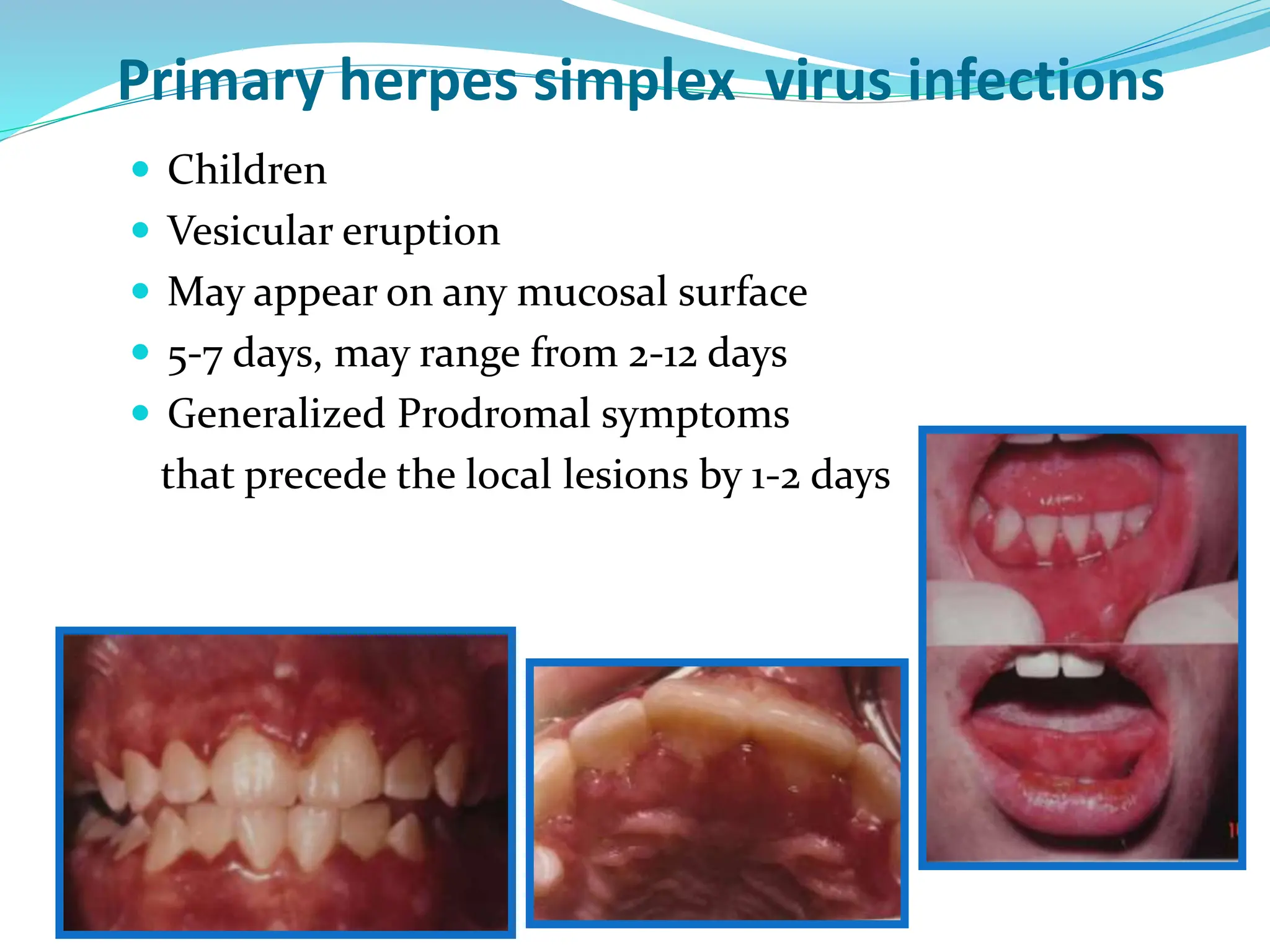 DD vesicular lesions.ppt