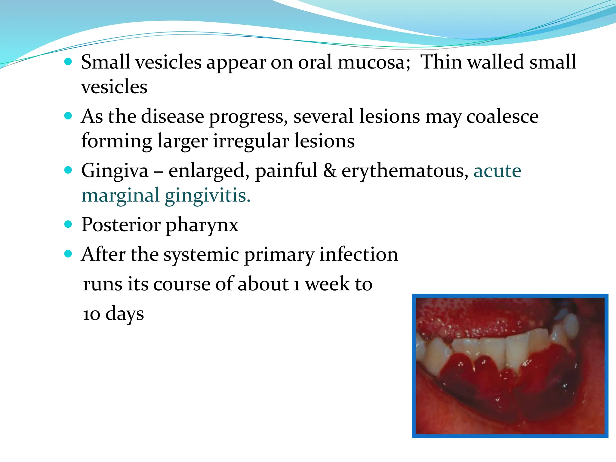 DD vesicular lesions.ppt