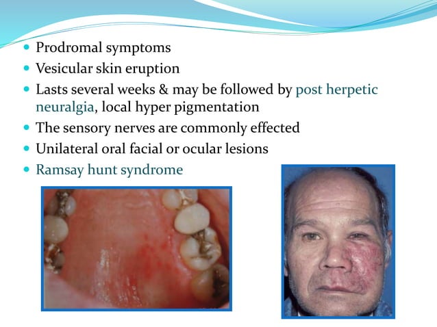 DD vesicular lesions.ppt