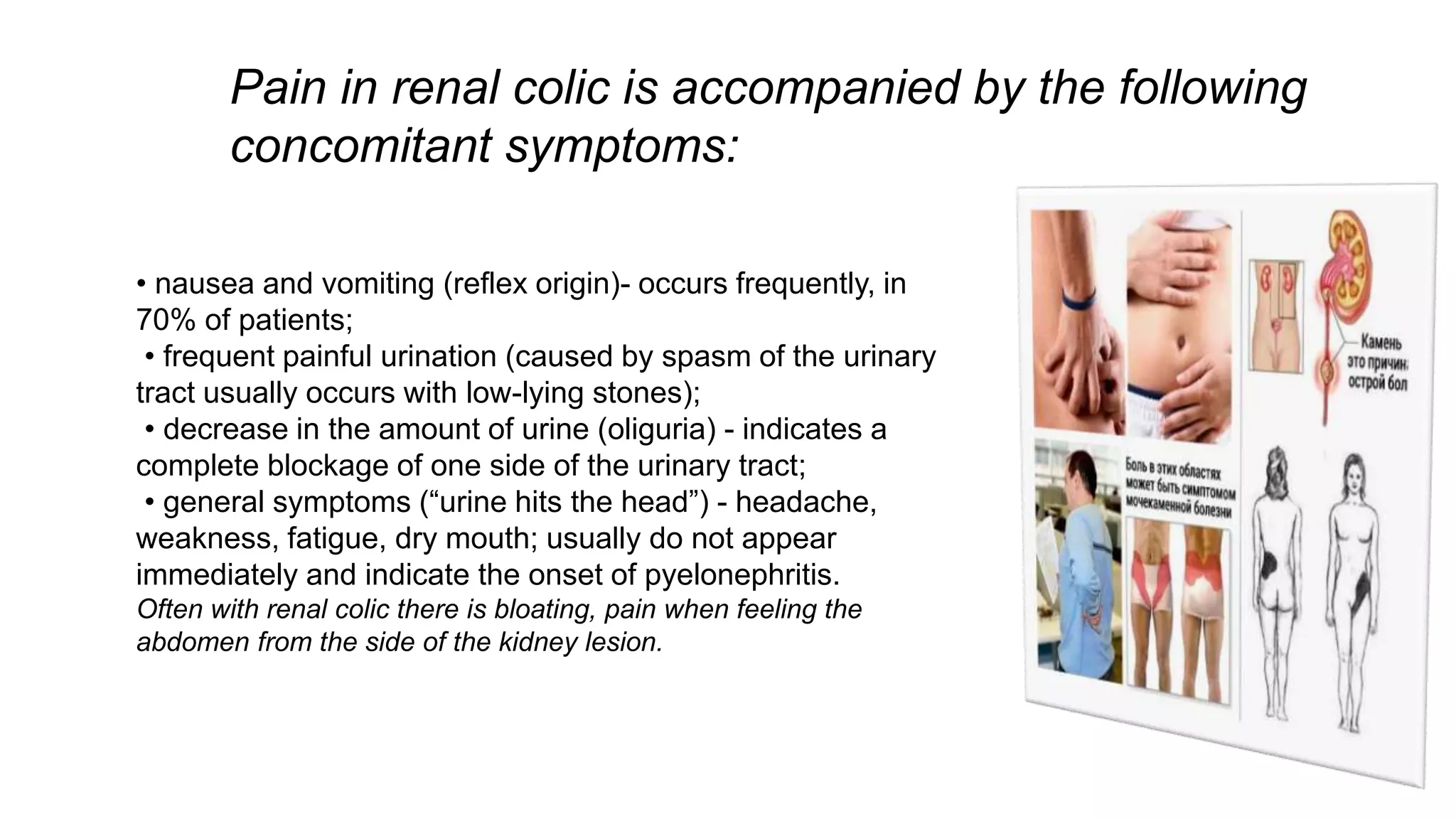 DDx ACUTE APPENDICITIS AND KIDNEY STONE.ru.en.pptx