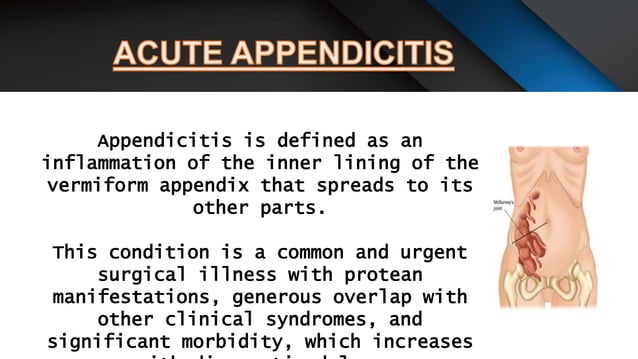 DDx ACUTE APPENDICITIS AND KIDNEY STONE.ru.en.pptx