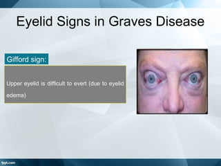 Differential Diagnosis of Proptosis | PPT
