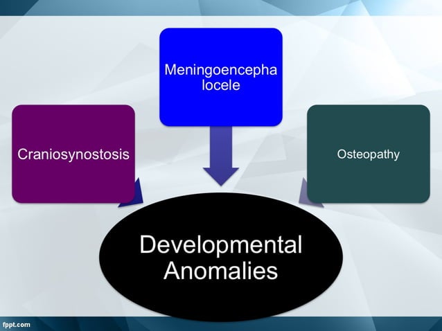 Differential Diagnosis of Proptosis | PPT
