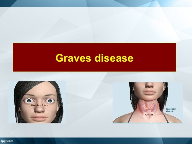 Differential Diagnosis of Proptosis