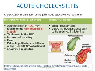 Differential Diagnsis OF UROLITHIASIS.pptx