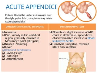Differential Diagnsis OF UROLITHIASIS.pptx