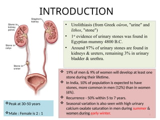 Differential Diagnsis OF UROLITHIASIS.pptx