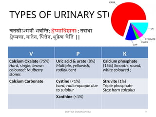 Differential Diagnsis OF UROLITHIASIS.pptx