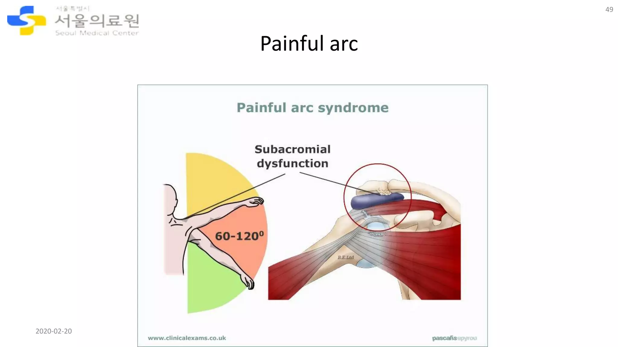 Differential Diagnosis and non-surgical treatment of chronic shoulder ...