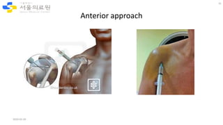 Differential Diagnosis and non-surgical treatment of chronic shoulder ...