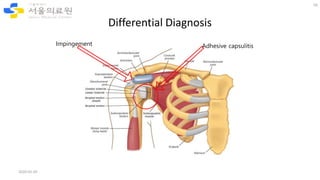 Differential Diagnosis and non-surgical treatment of chronic shoulder ...