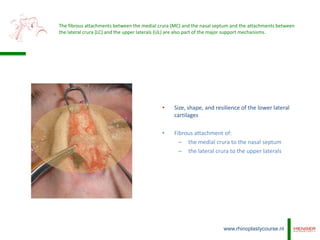 De-projection of the nasal tip | PPTX