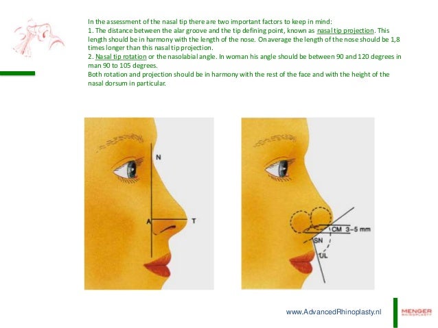 De Projection Of The Nasal Tip