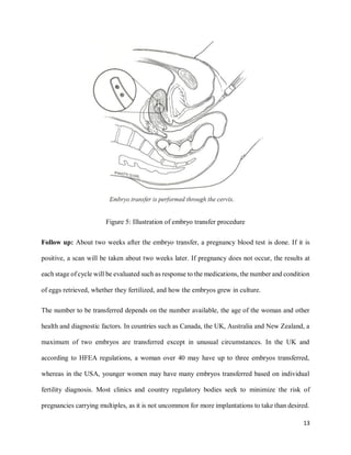 BASIC STEPS IN IN VITRO FERTILIZATION (IVF) | PDF