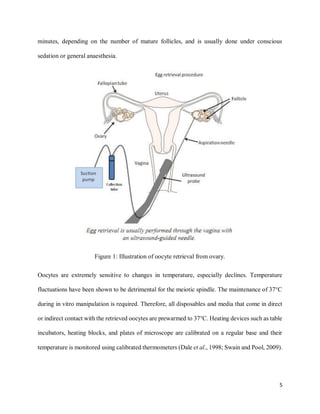 BASIC STEPS IN IN VITRO FERTILIZATION (IVF) | PDF