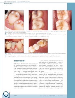 3year Surefil clinical | PDF