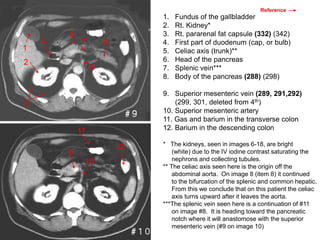 Cross Sectional Anatomy | PPT